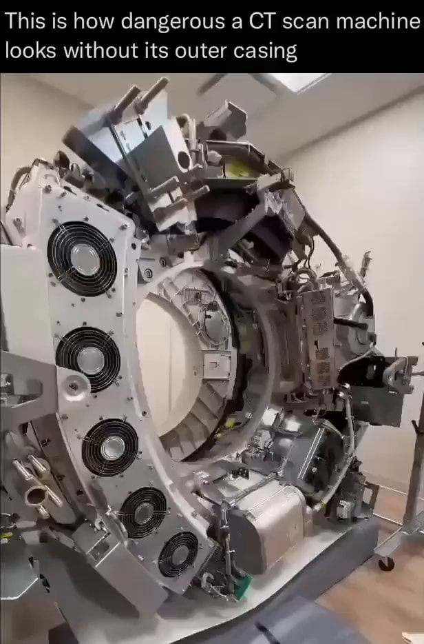 This is how dangerous a CT scan machine looks without its outer casing ...